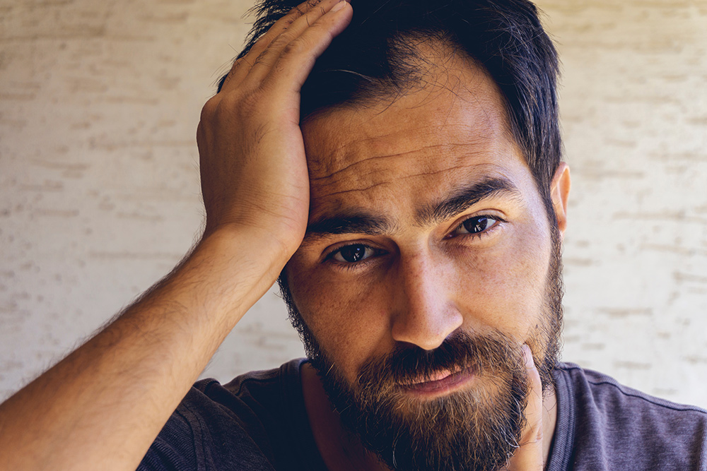 Early Signs of Balding | Dr Malay Mehta