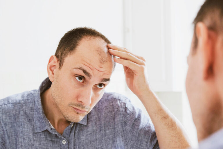 Early Signs of Balding | Dr Malay Mehta